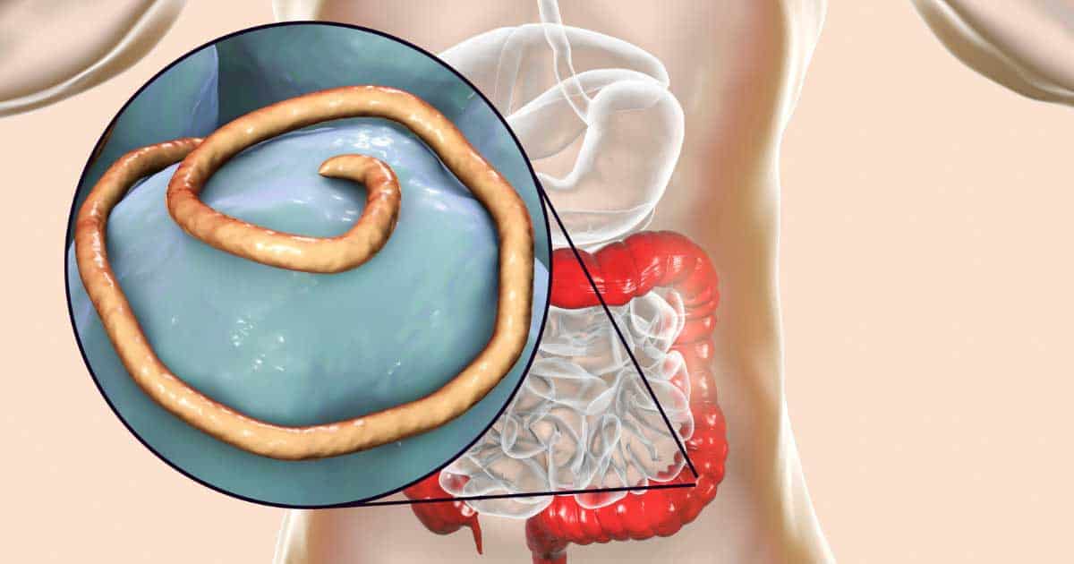 Gut Issues? Explore Intestinal Parasites | Metabolix Health