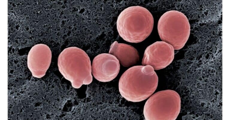 Functional Medicine: Candida Overgrowth | Metabolix Health